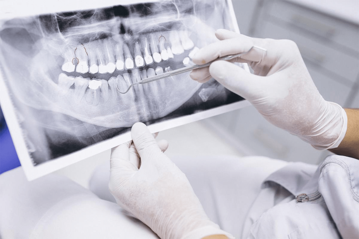Cirurgia bucomaxilofacial: como funciona? | Otorrino Paulista